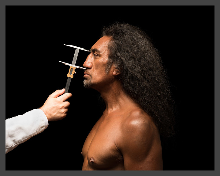 Yuki Kihara | Subnasale-nasal Root Length with Vernier Caliper ...